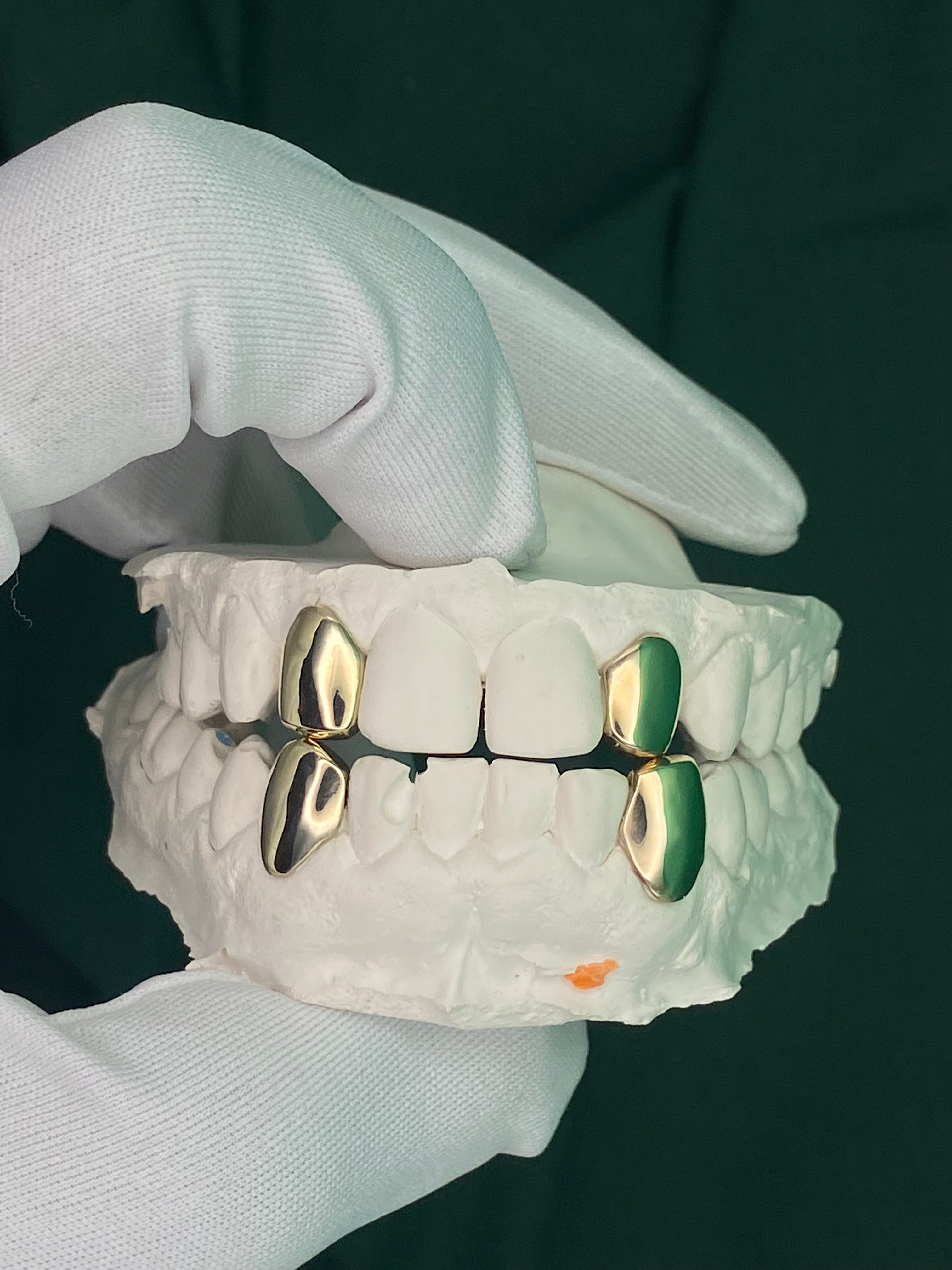 4 Solid Caps – Green Skull Grillz