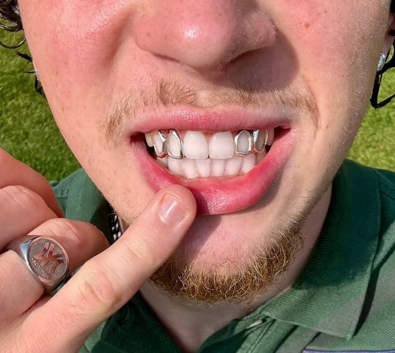 Green Skull Grillz | UK, US and EU Shipping